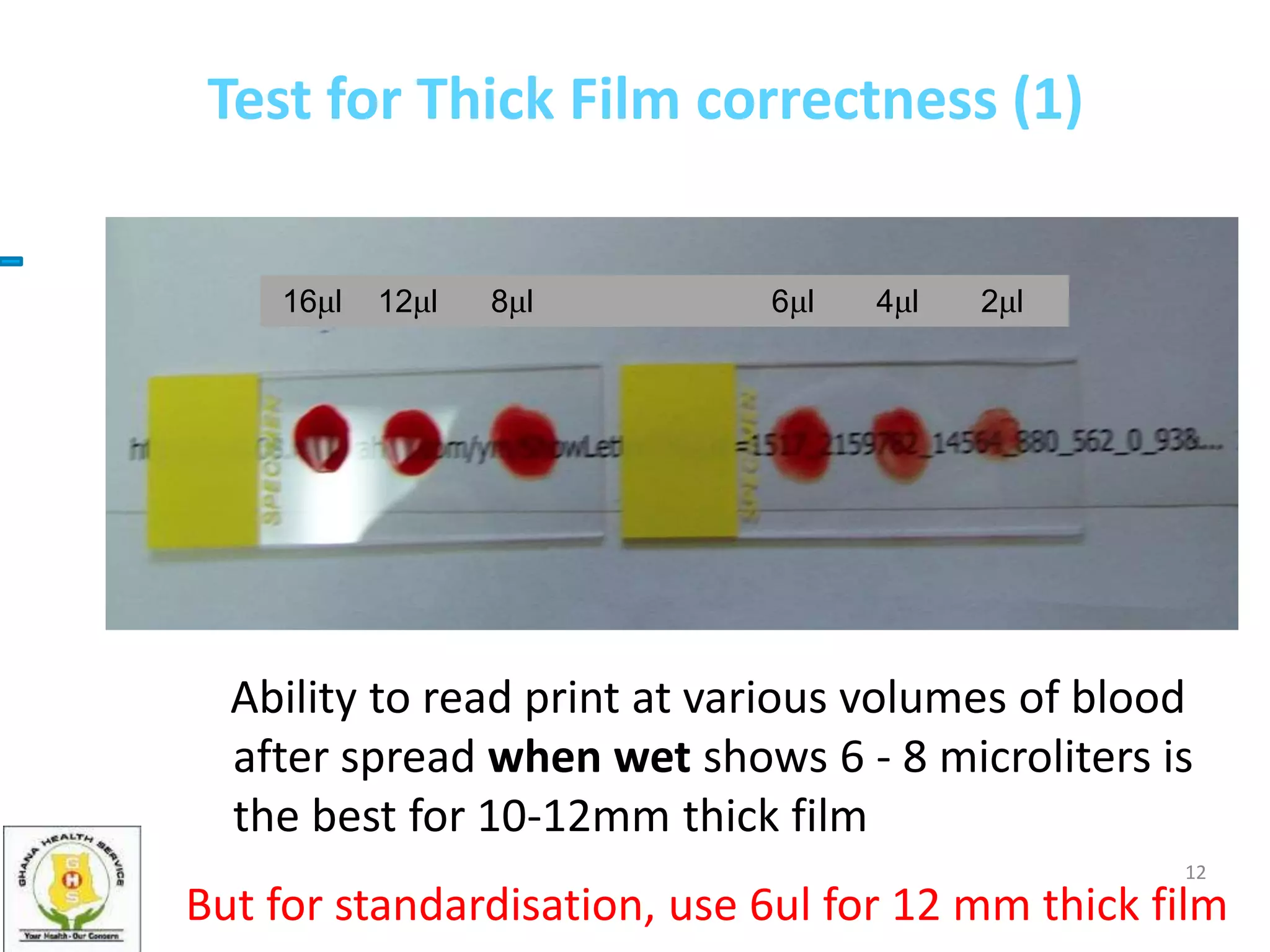 2. Preparation and staining of thick and thin blood films.ppt