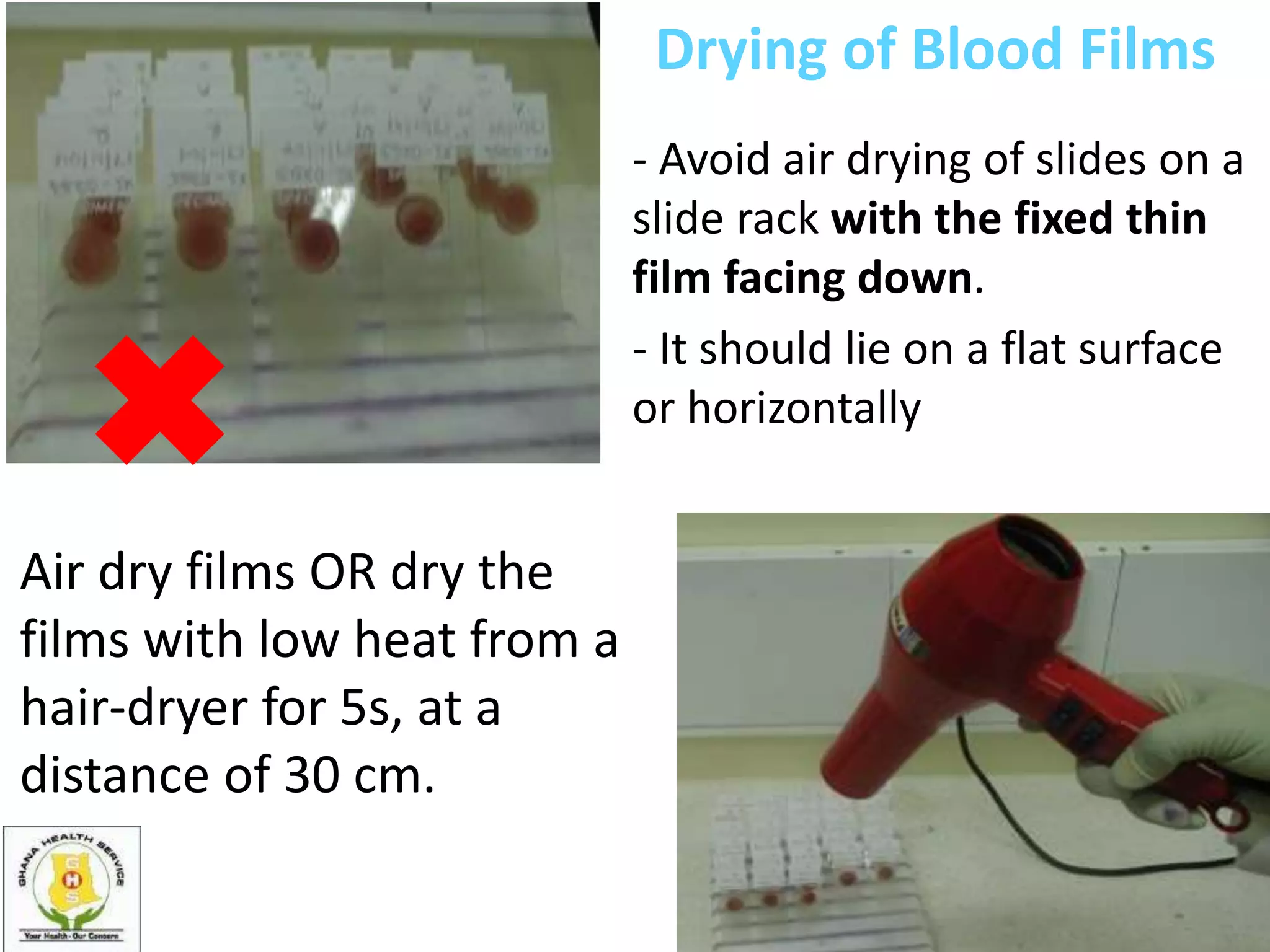 2. Preparation and staining of thick and thin blood films.ppt
