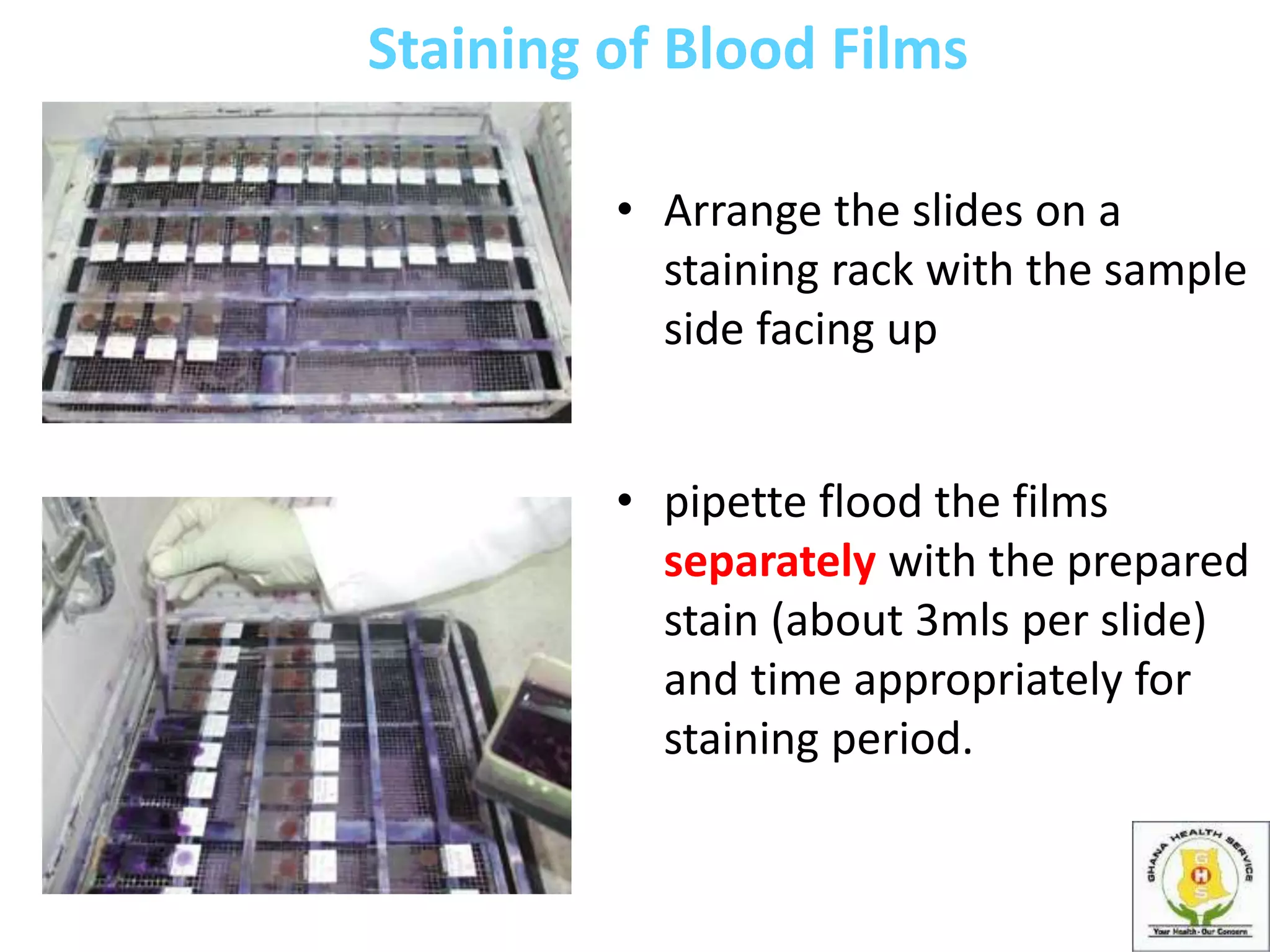2. Preparation and staining of thick and thin blood films.ppt