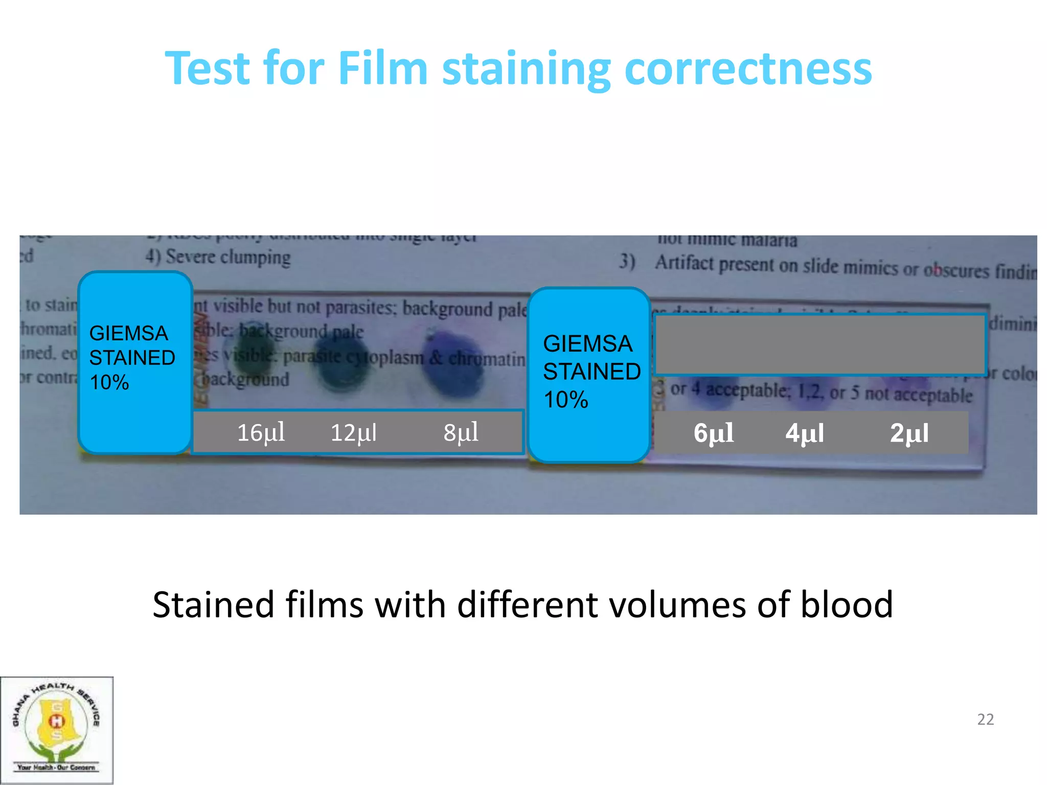 2. Preparation and staining of thick and thin blood films.ppt
