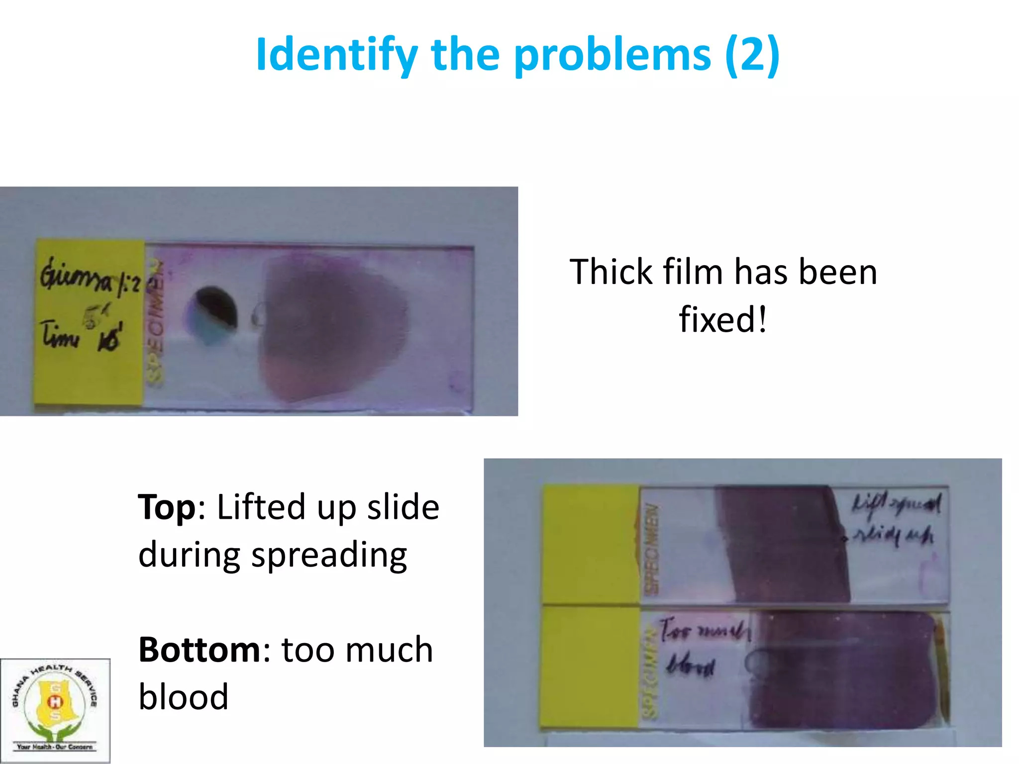 2. Preparation and staining of thick and thin blood films.ppt