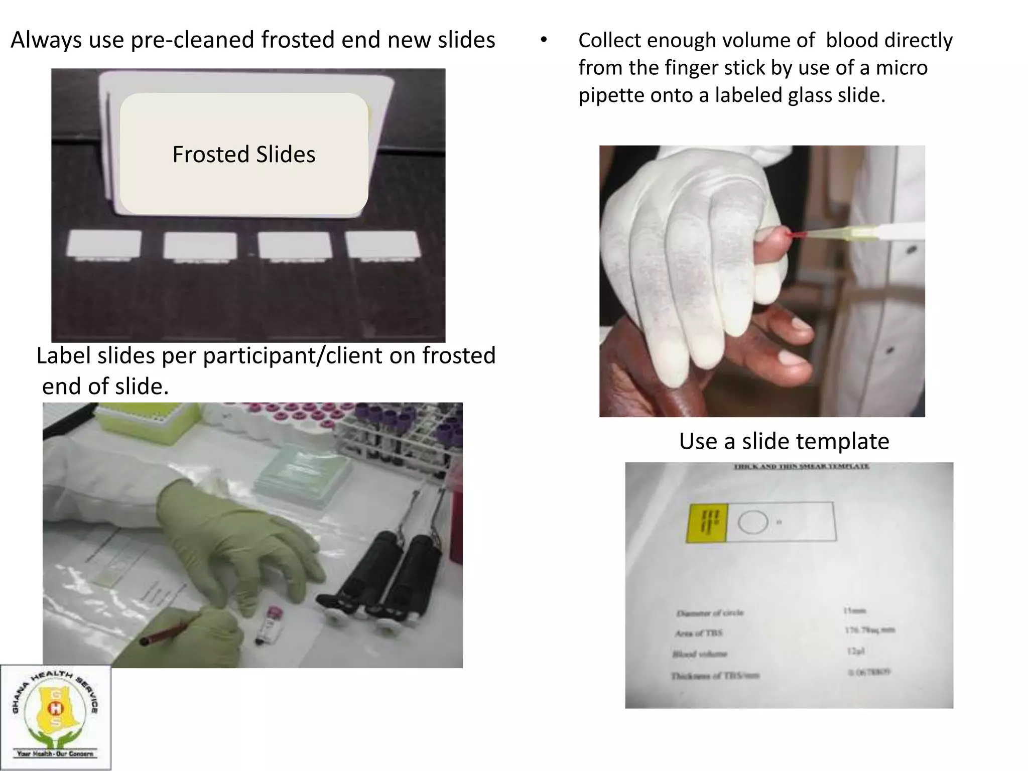2. Preparation and staining of thick and thin blood films.ppt