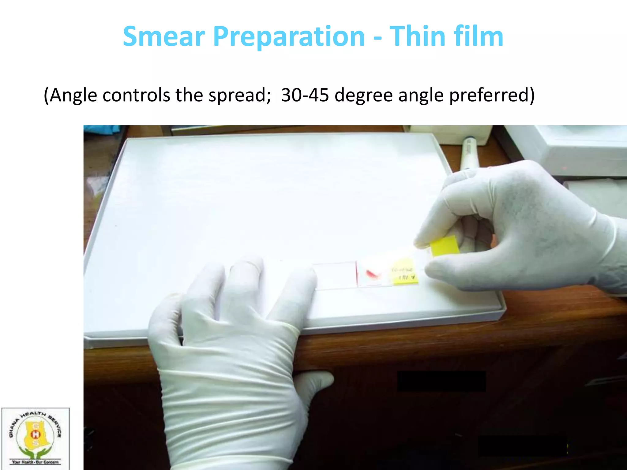 2. Preparation and staining of thick and thin blood films.ppt