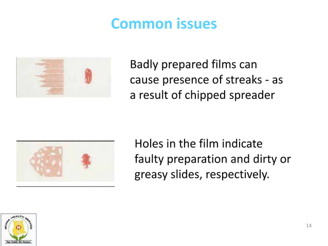 2. Preparation and staining of thick and thin blood films.ppt