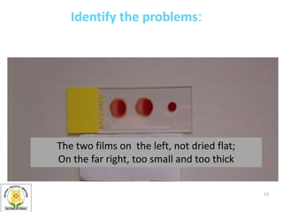 2. Preparation and staining of thick and thin blood films.ppt
