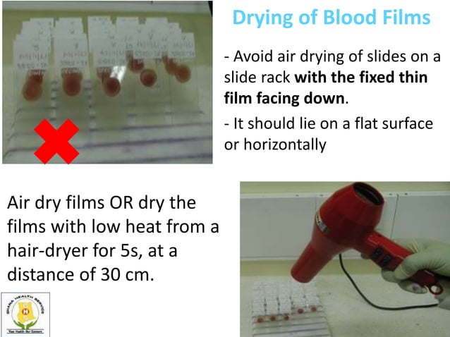 2. Preparation and staining of thick and thin blood films.ppt
