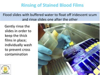 2. Preparation and staining of thick and thin blood films.ppt