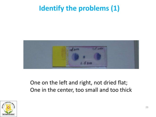 2. Preparation and staining of thick and thin blood films.ppt