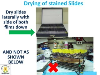 2. Preparation and staining of thick and thin blood films.ppt