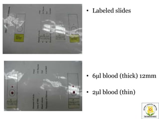 2. Preparation and staining of thick and thin blood films.ppt