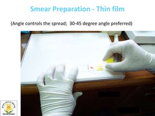 2. Preparation and staining of thick and thin blood films.ppt