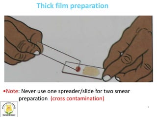 2. Preparation and staining of thick and thin blood films.ppt