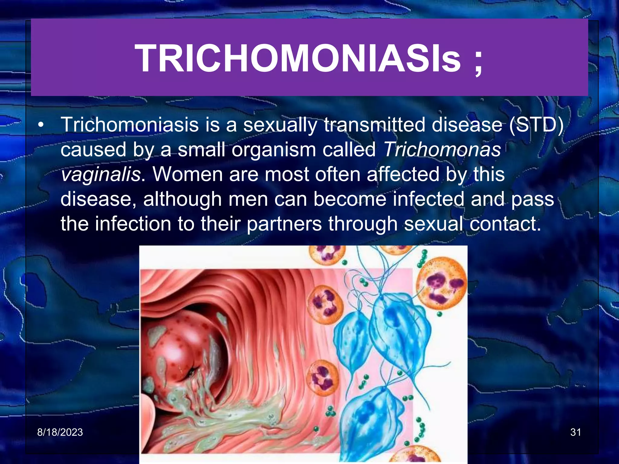 SEXUAL TRANSMITED DISEASE (STD).ppt
