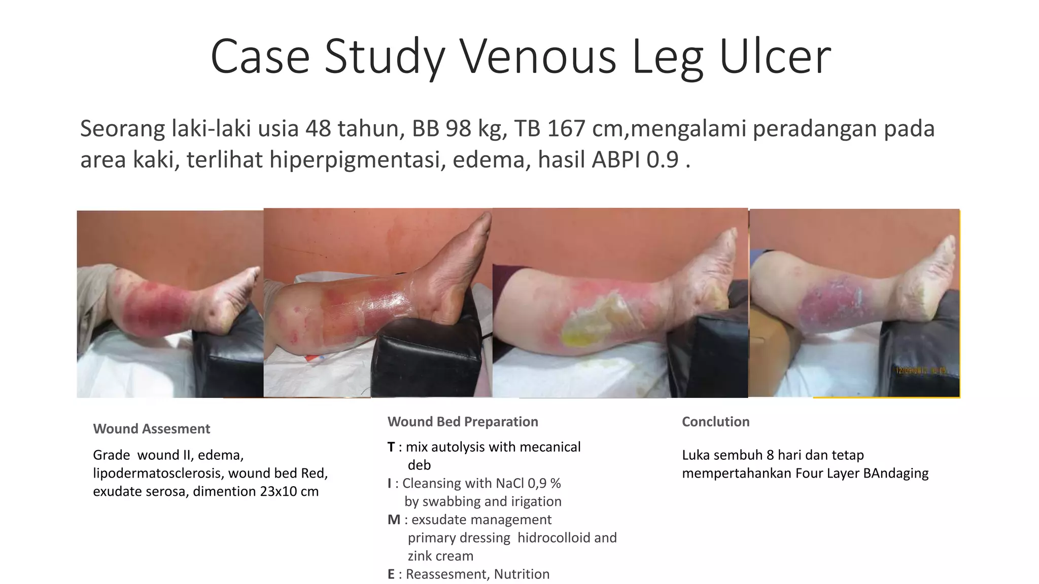 2. Ns Edy_venous and artery ulcer).pptx