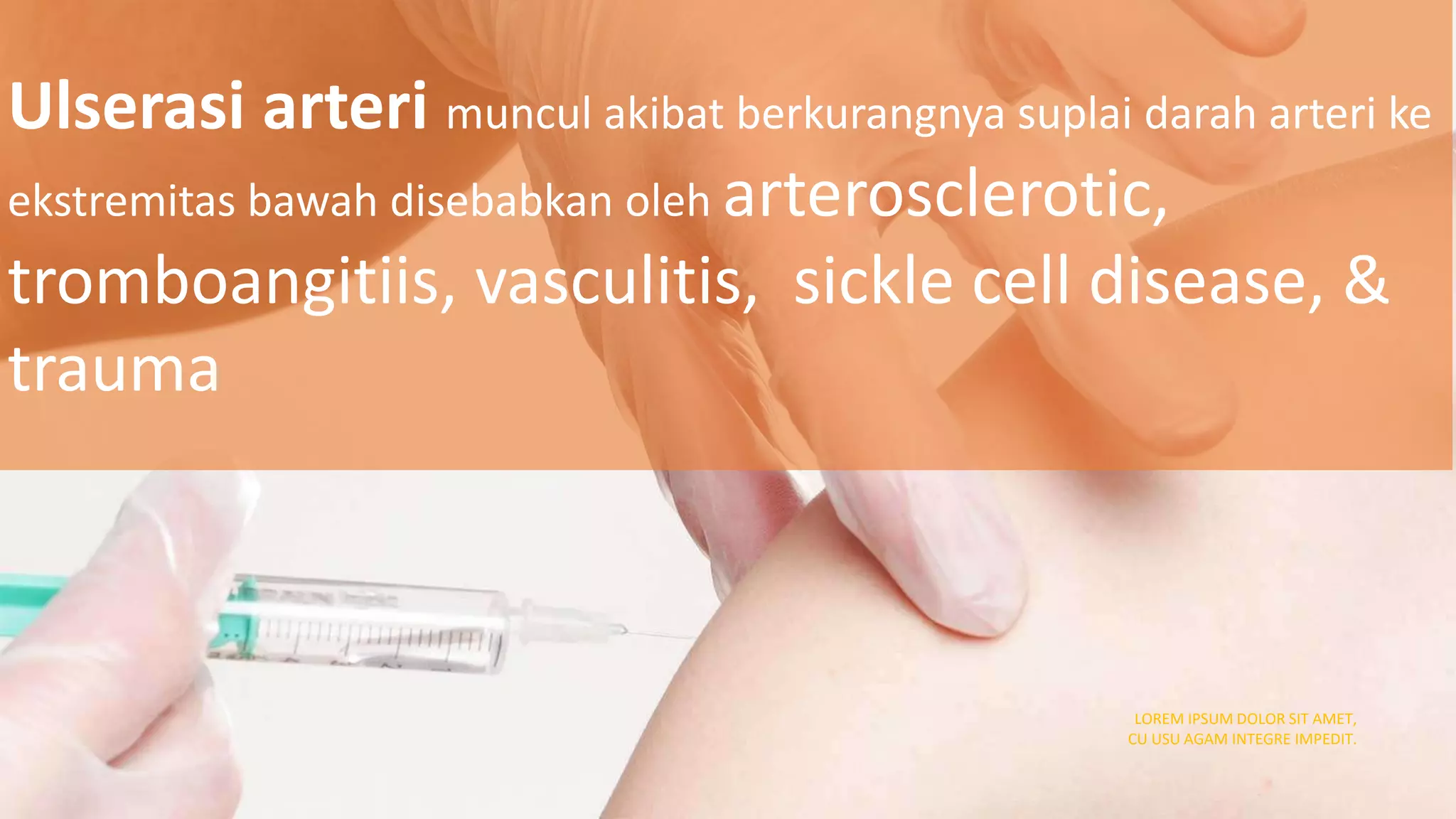 2. Ns Edy_venous and artery ulcer).pptx