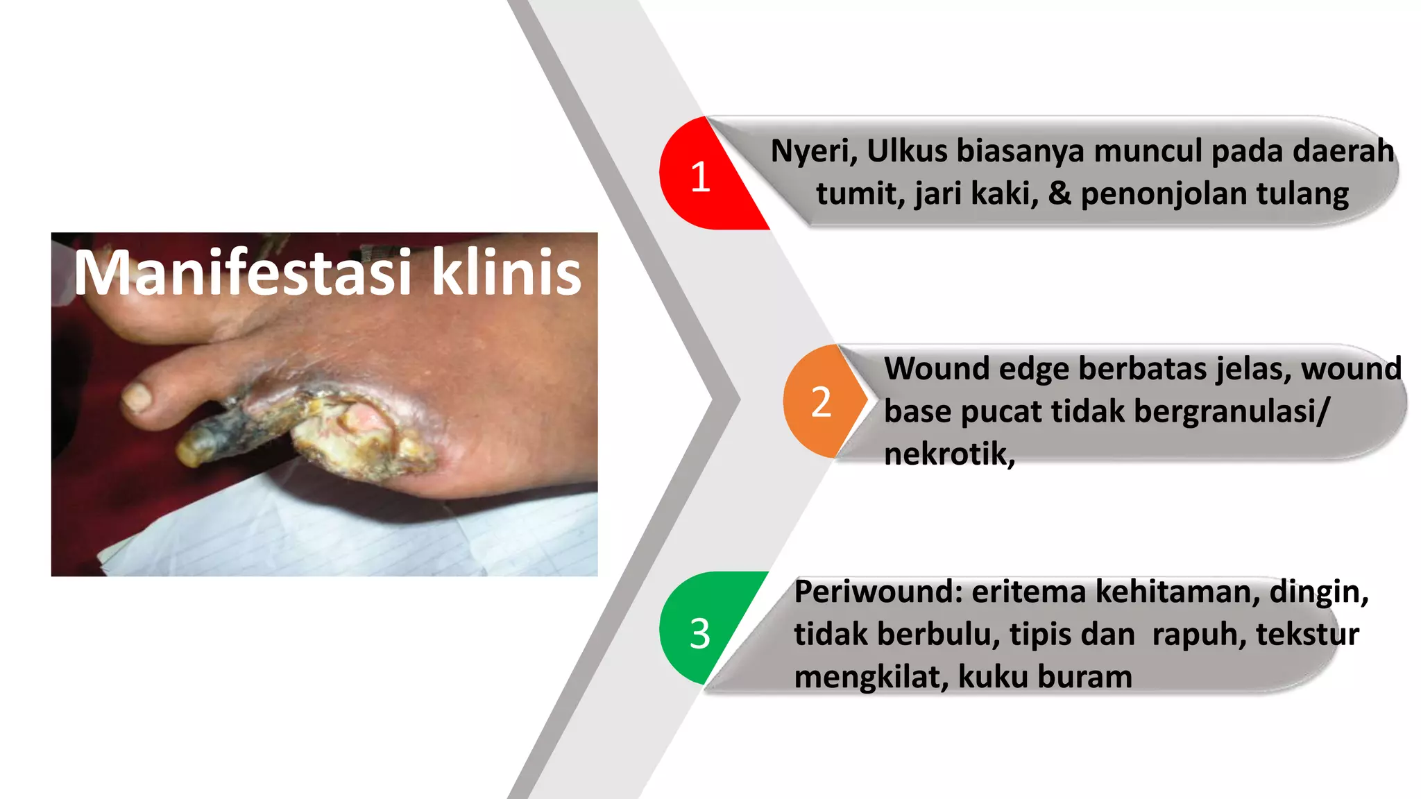 2. Ns Edy_venous and artery ulcer).pptx