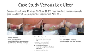 2. Ns Edy_venous and artery ulcer).pptx