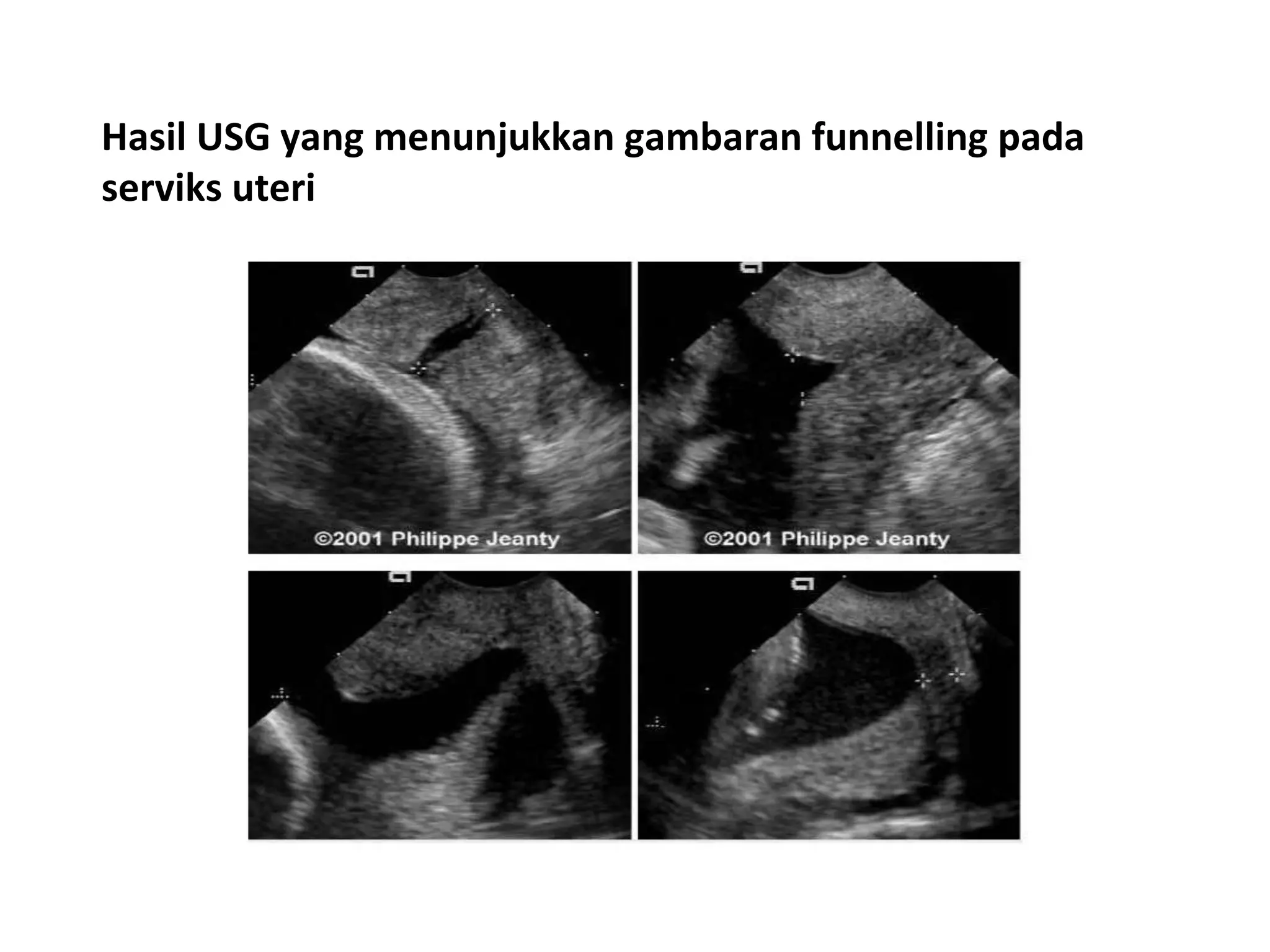 2. PATOFISIOLOGI FETOMATERNAL dr. Taufik.pptx