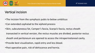 2. HowtoExposure.pptx