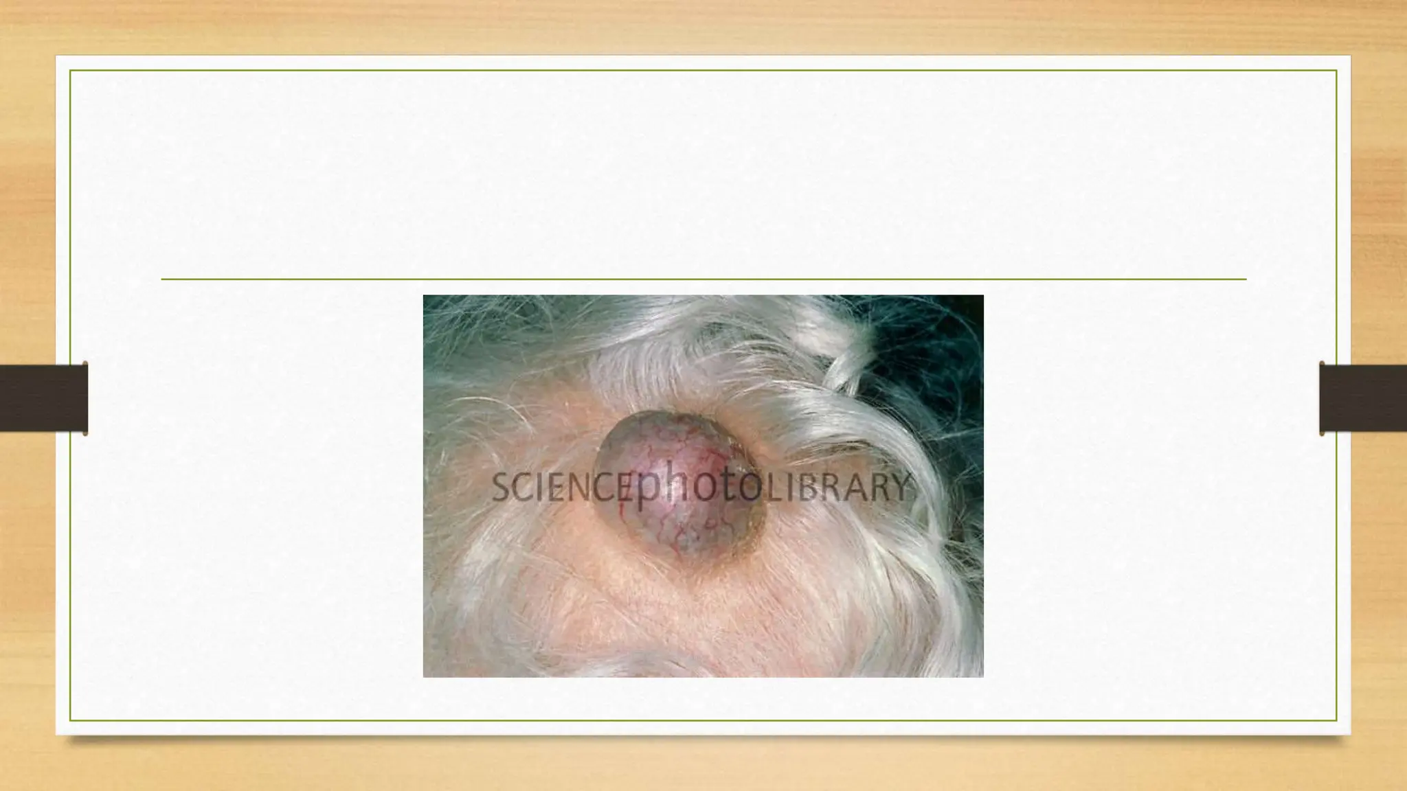 2. Clinical anatomy scalp.ppt