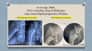 Principles of Containment in PERTHES AKU August 2023.pptx
