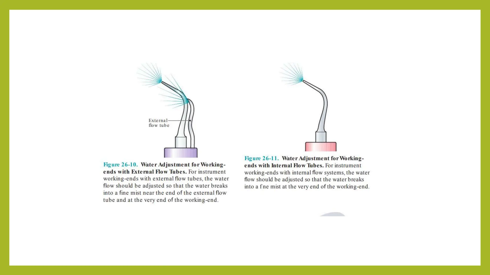 Sonic and ultrasonic instruments in periodontology.pptx