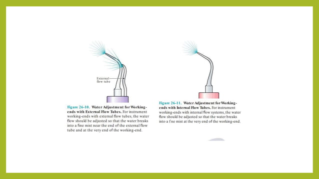 Sonic and ultrasonic instruments in periodontology.pptx | Oral care ...