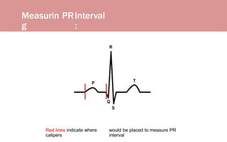 Basic of ECG Referesher Course | PPTX