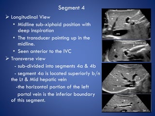 2.Segemental Anatomy of the liver.pdf