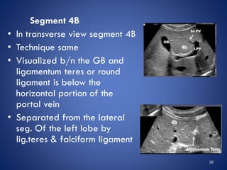2.Segemental Anatomy of the liver.pdf