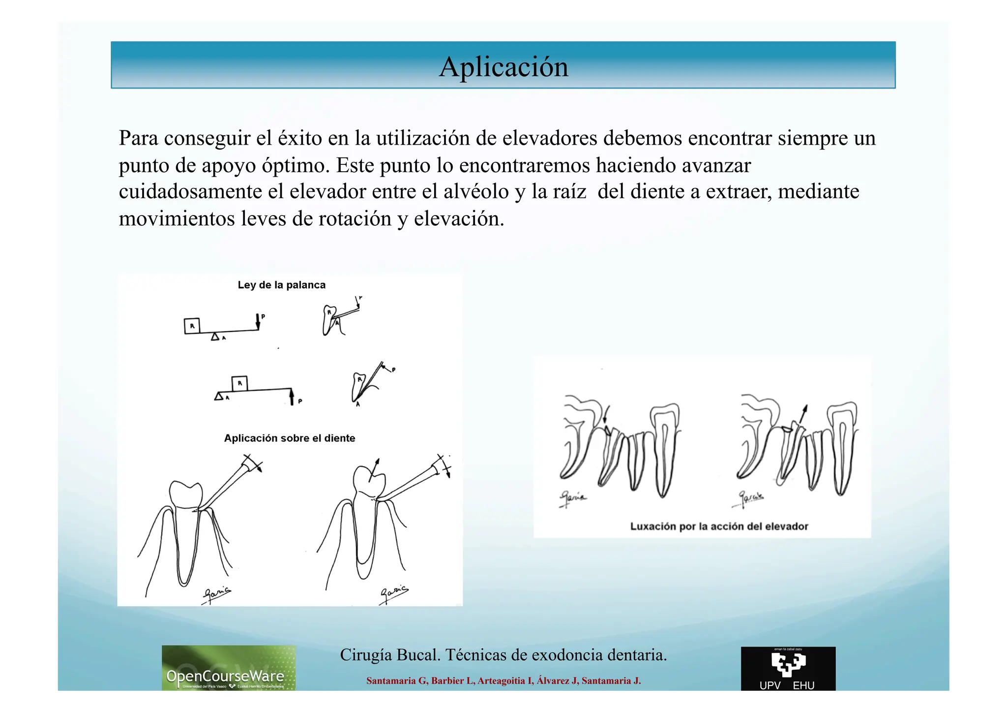 2.3_Tiempos_de_la_exodoncia_con_forceps_y_con_elevadores.pdf
