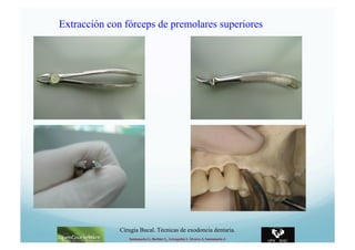 2.3_Tiempos_de_la_exodoncia_con_forceps_y_con_elevadores.pdf