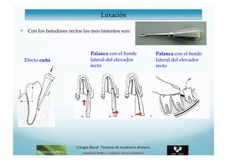 2.3_Tiempos_de_la_exodoncia_con_forceps_y_con_elevadores.pdf