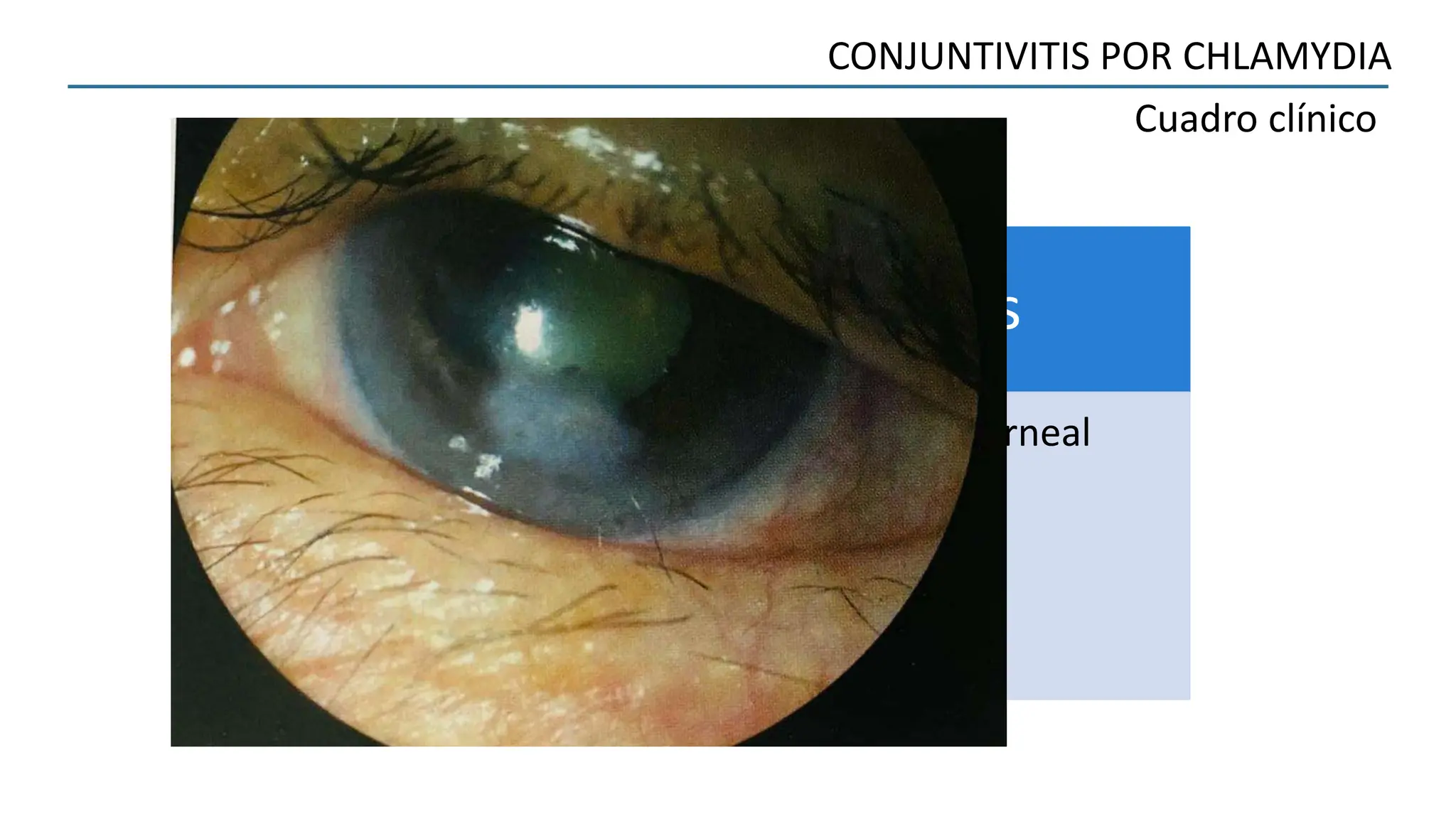 2.- CONJUNTIVITIS CLAMIDIA.pptx--.......... | PPTX