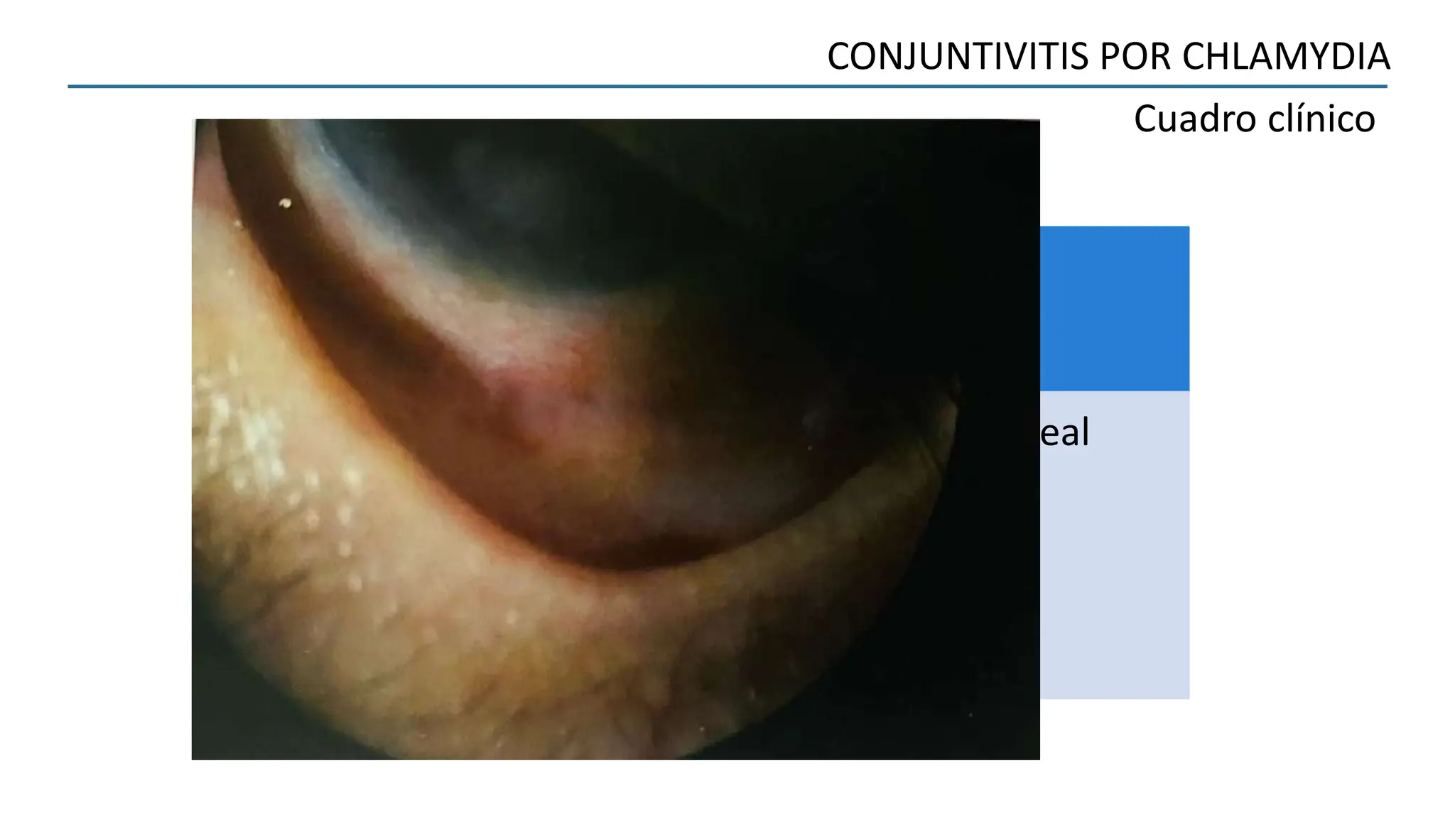 2.- CONJUNTIVITIS CLAMIDIA.pptx--.......... | PPTX
