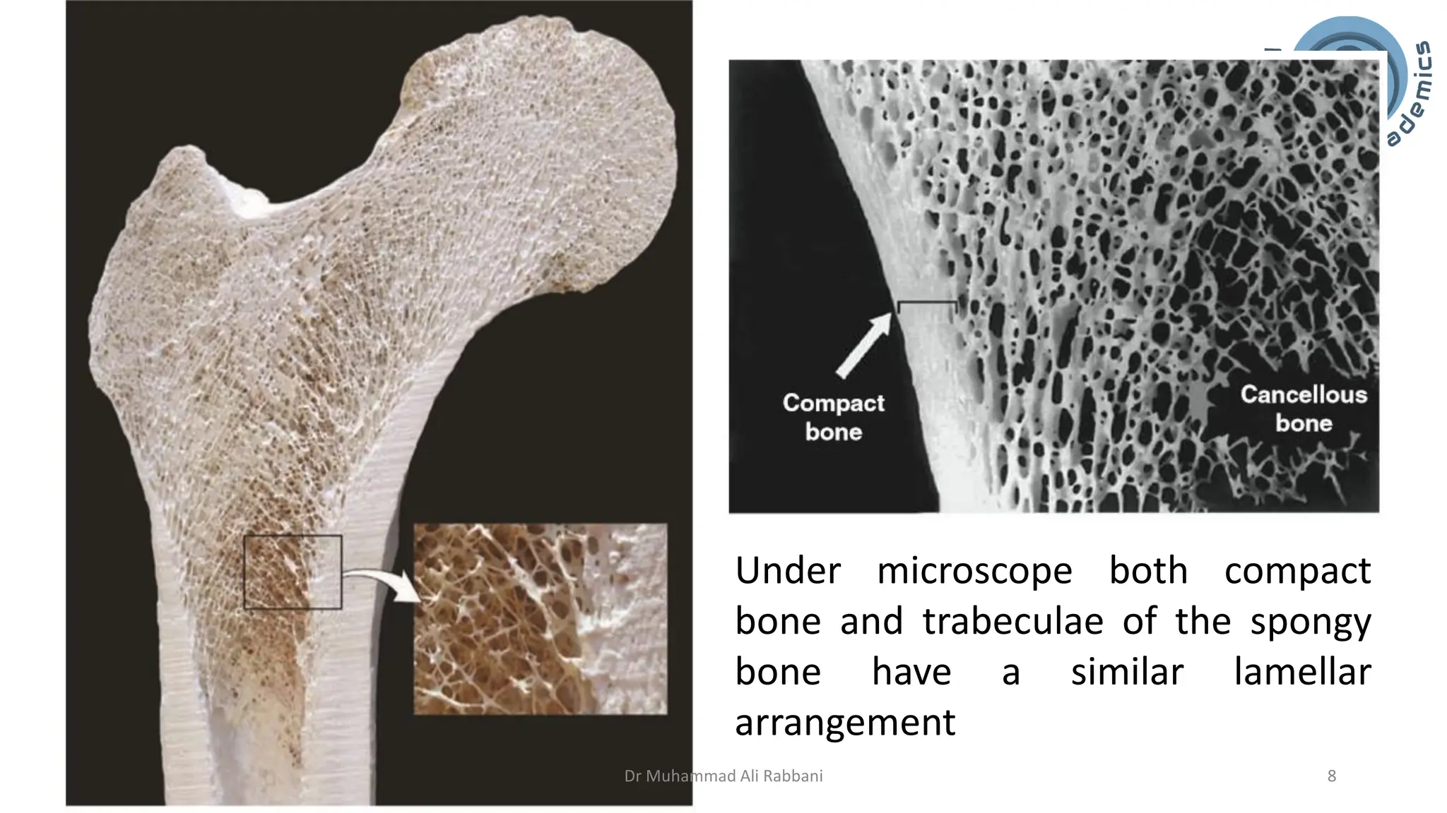General Anatomy of Bone, Skeleton, and Cartilage | PDF