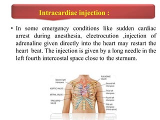2. Routes of Drug Administration.pptx