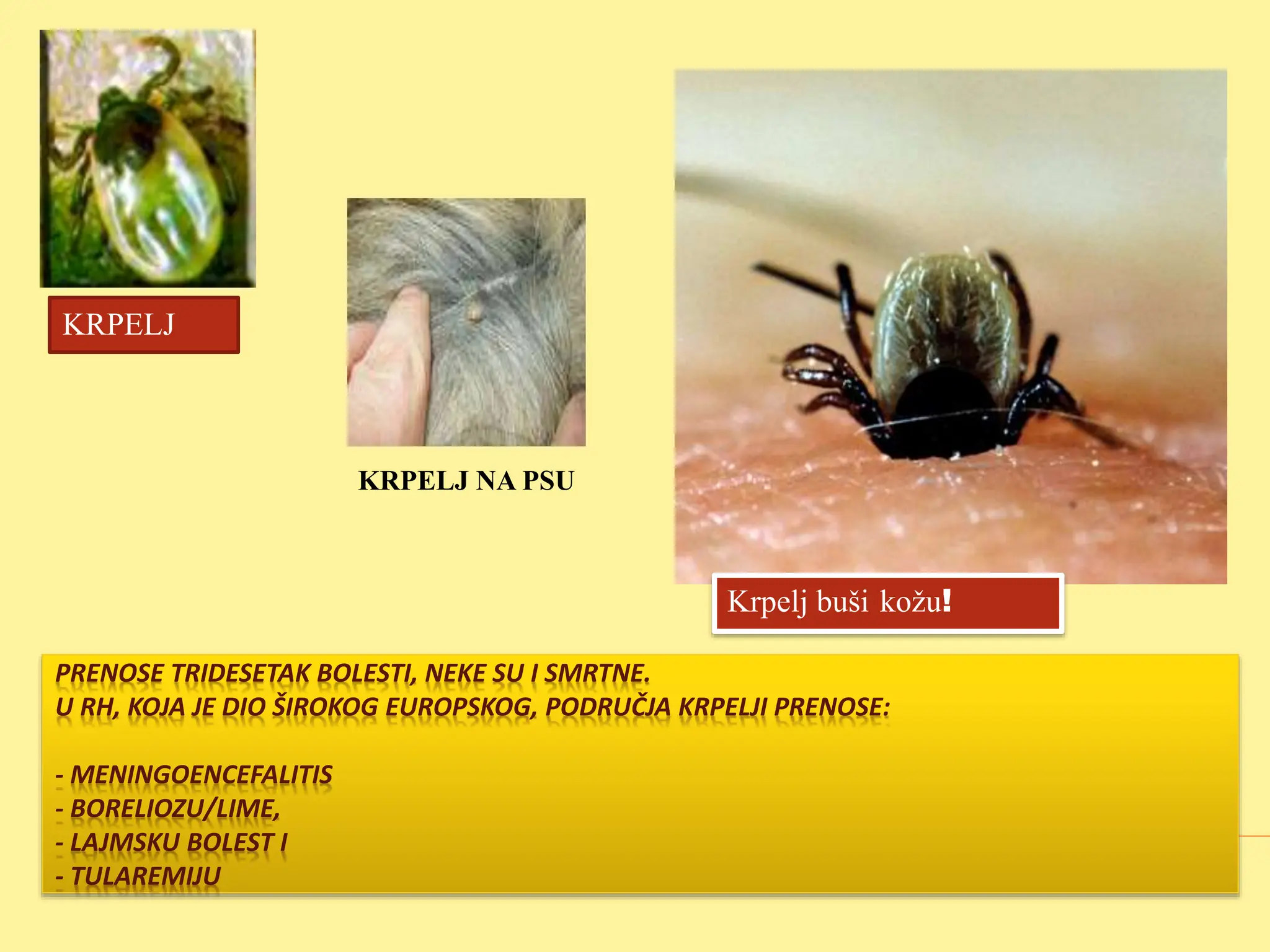 2. ZARAZNE BOLESTI.pptx