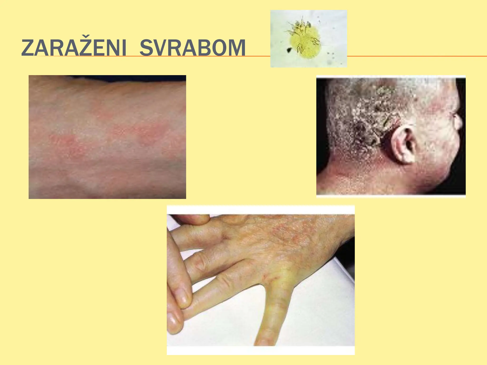 2. ZARAZNE BOLESTI.pptx