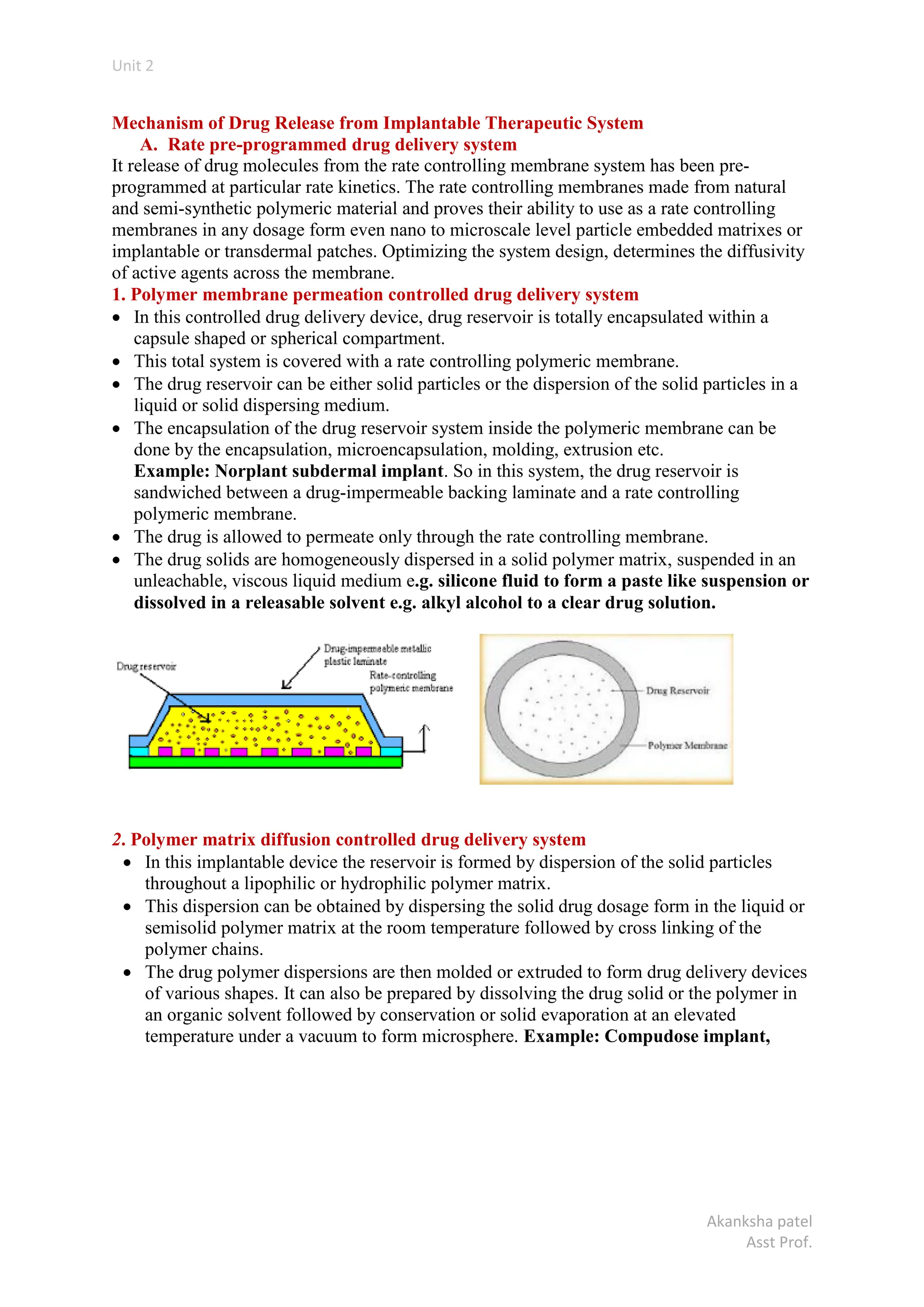 Implantable drug delivery systems | PDF