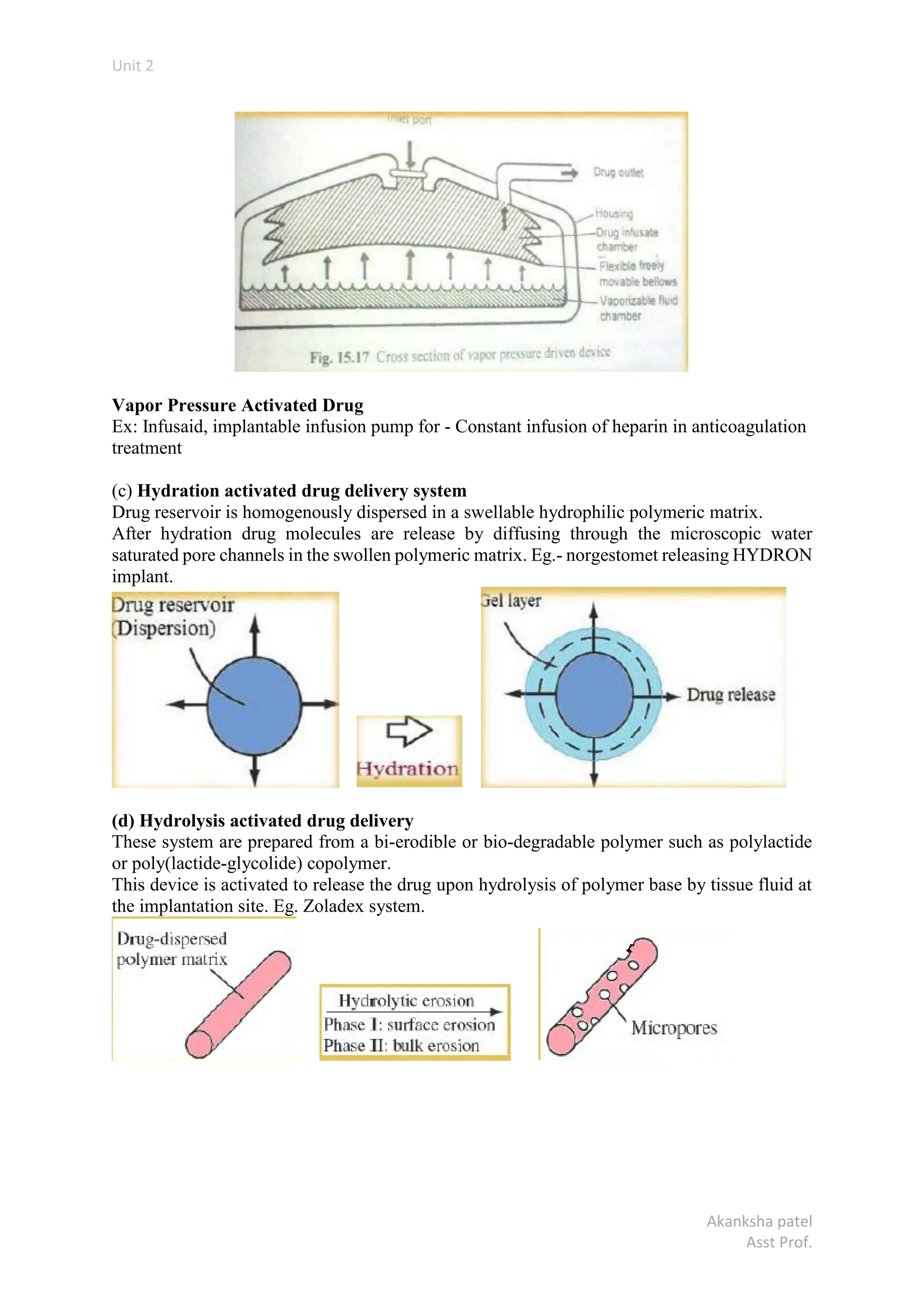 Implantable drug delivery systems | PDF