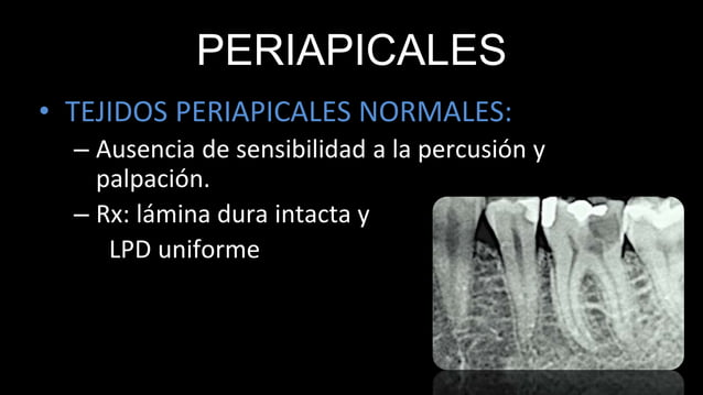 2.PATOLOGIA PULPAR Y PERIAPICALppt.pptx. | PPT | Descarga Gratuita