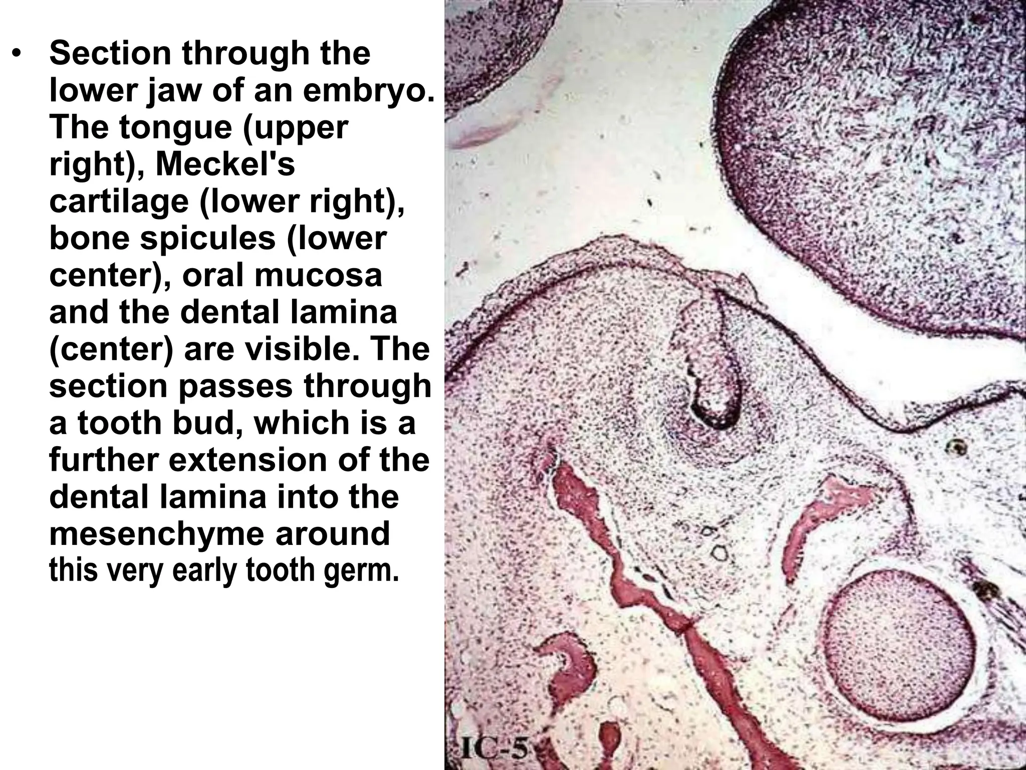 2. Development of tooth.ppt ODONTOGENESIS | PPT