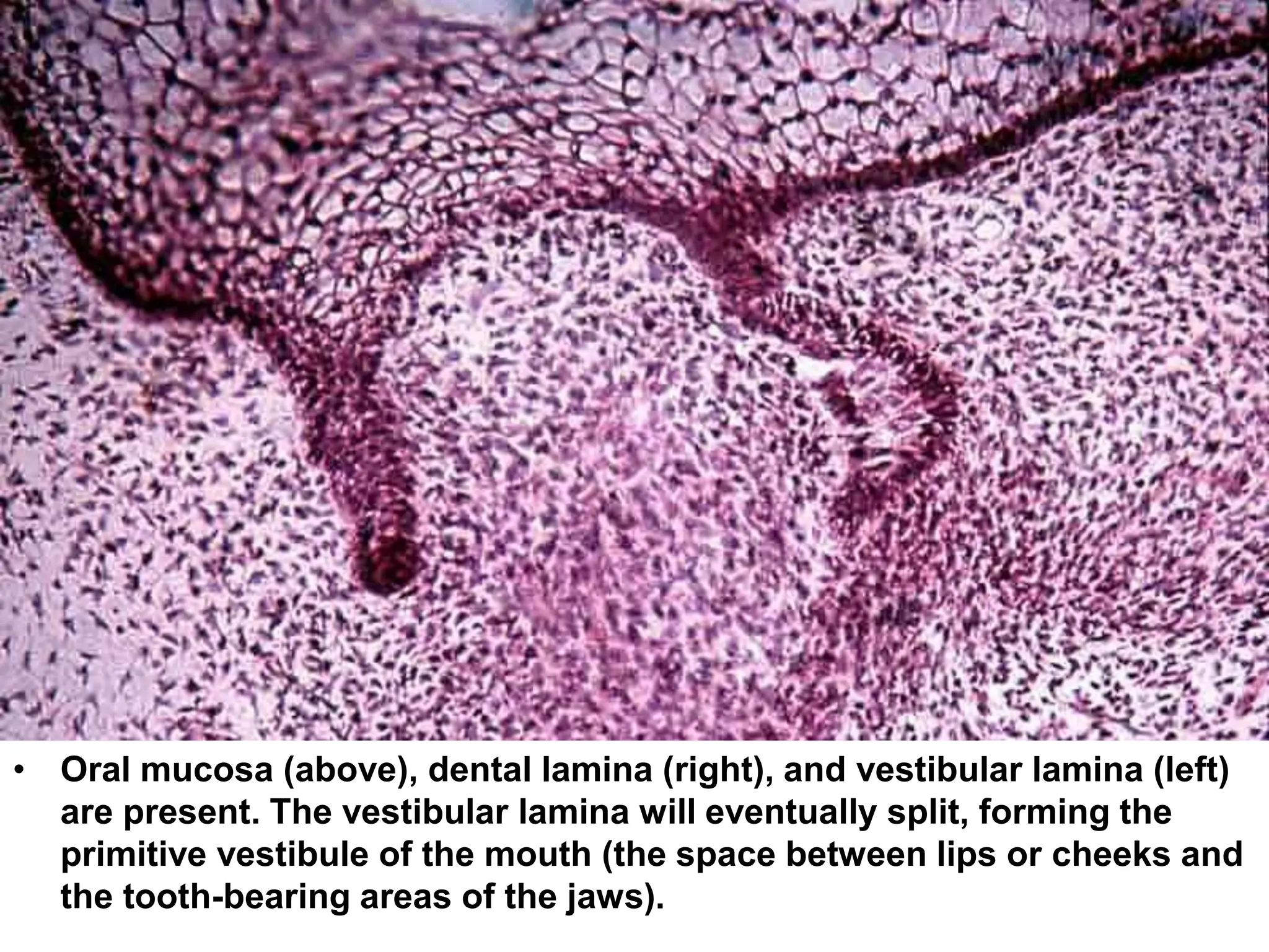 2. Development of tooth.ppt ODONTOGENESIS | PPT