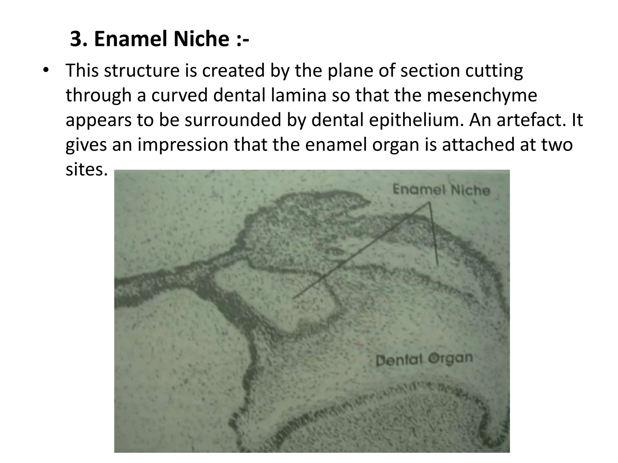 2. Development of tooth.ppt ODONTOGENESIS | PPT