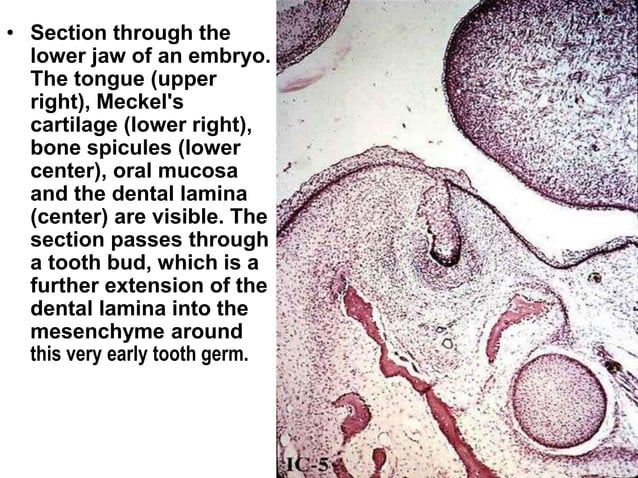 2. Development of tooth.ppt ODONTOGENESIS | PPT | Dental Health | Diseases and Conditions