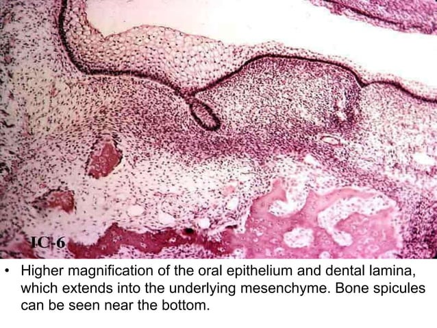 2. Development of tooth.ppt ODONTOGENESIS | PPT | Dental Health | Diseases and Conditions