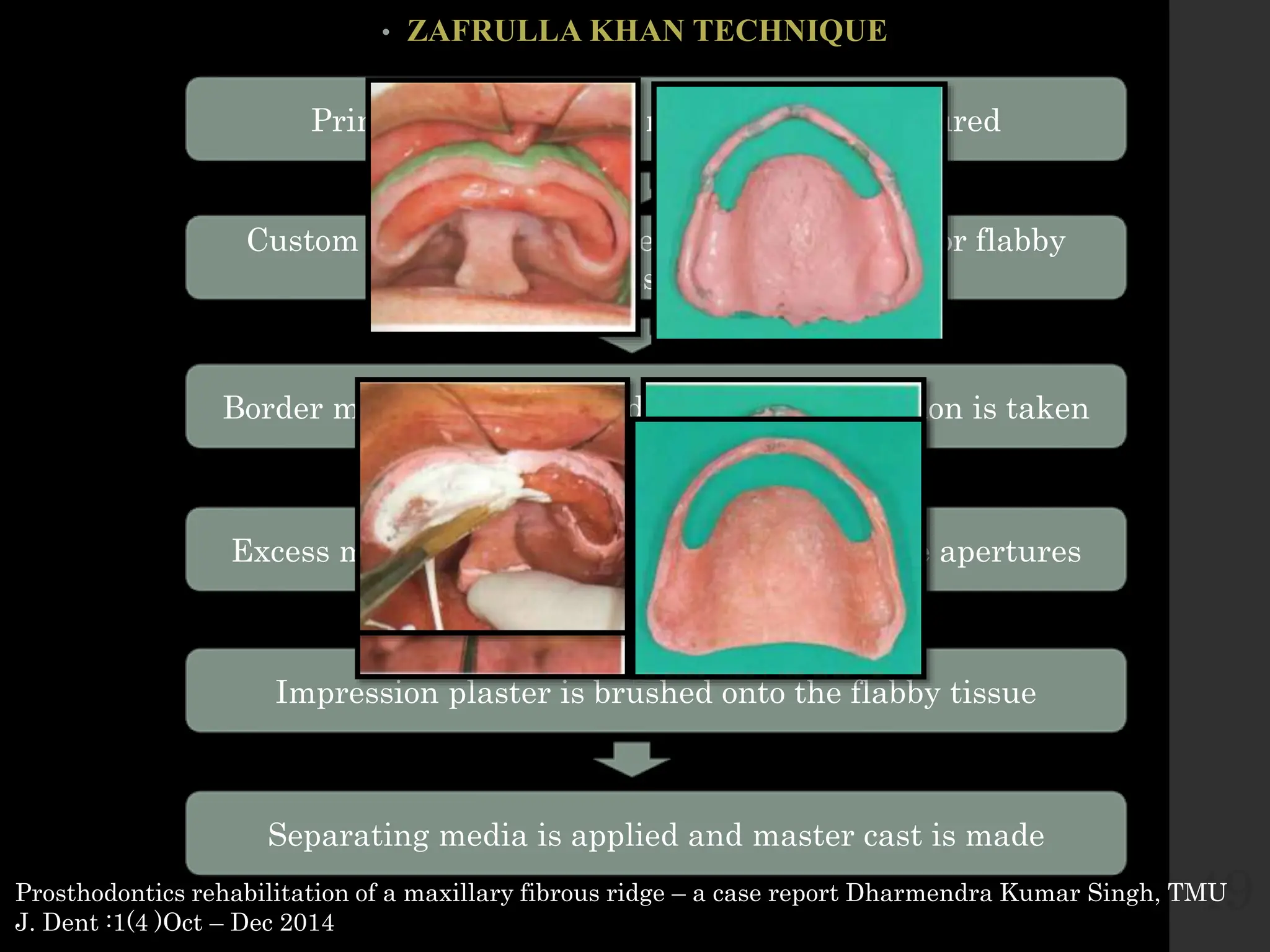 2. EVALUATION OF IMPRESSION TECHNIQUE IN COMPLETE DENTURE.pptx