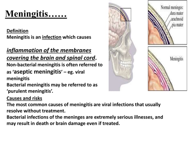 2. Meningitis diseses of the brain membrane.pptx