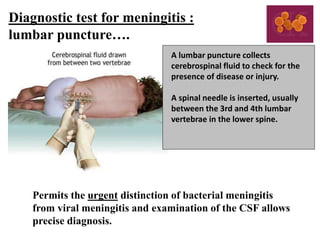 2. Meningitis diseses of the brain membrane.pptx